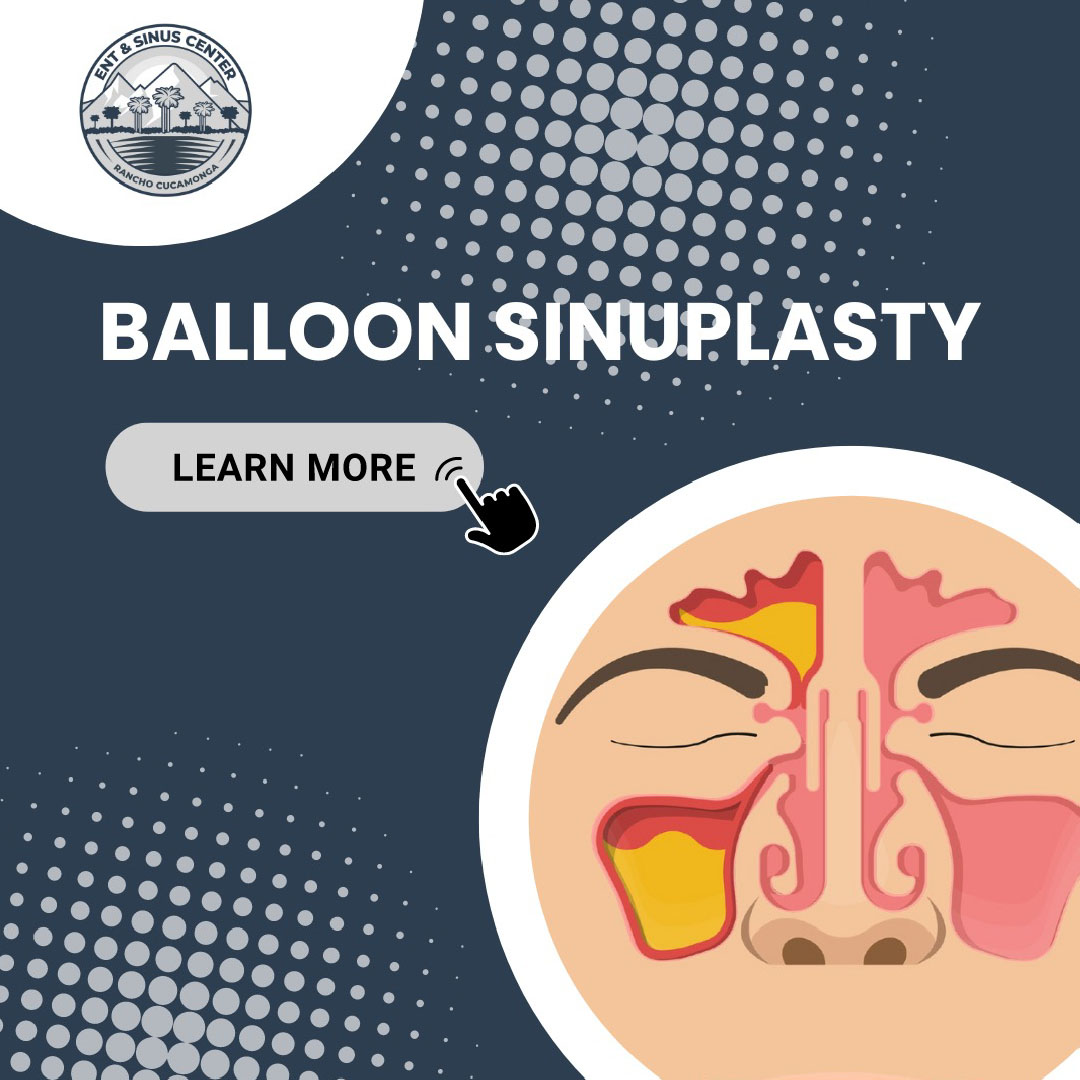 Sinus Infection Treatment | ENT & Sinus Center